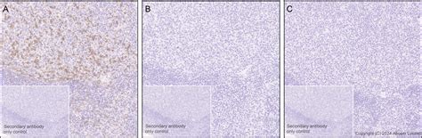 Anti Digoxigenin Antibody [epr26829 63] Ab320717 Abcam