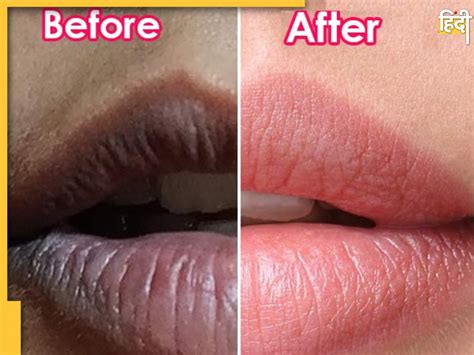 Pink Lips Tips काले हो गए होंठ को गुलाबी बना देंगे ये नुस्खे बिन