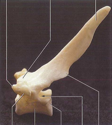 Thoracic Vertebra Lateral View Diagram Quizlet