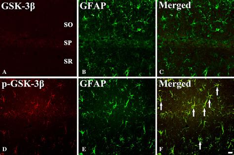Double Immunofluorescence Staining For Gsk 3β Red A Or P Gsk 3β