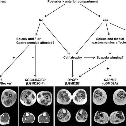 1 Algorithm For The Differential Diagnosis Of Congenital Myopathies Download Scientific Diagram