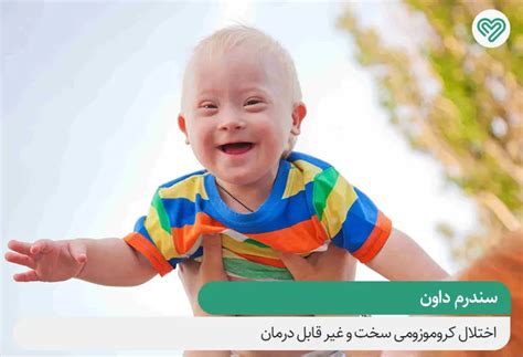 انواع بیماری های ژنتیکی رایج در جهان