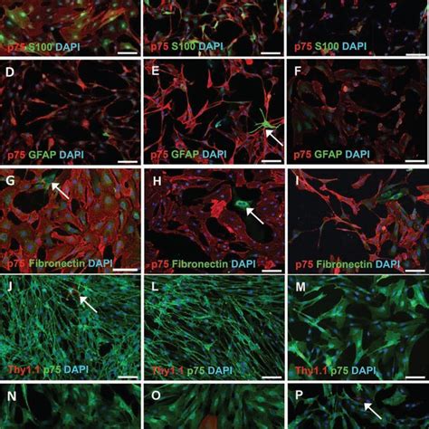 The Antigenic Profile Of Cultured Oecs From Embryonic A D G K N