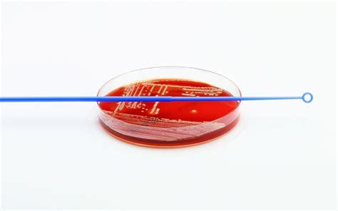 박테리아 메티실린 내성 황색포도상구균의 배양물이 있는 한천혈액 배지가 있는 페트리 접시 0명에 대한 스톡 사진 및 기타 이미지 Istock