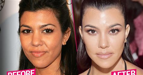 Kourtney Kardashians Massive Plastic Surgery Makeover Exposed By Top Docs