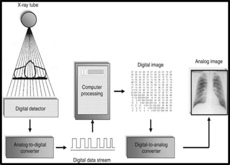 Processing Digital Images Rt Radiographic Images And Physics Flashcards Quizlet