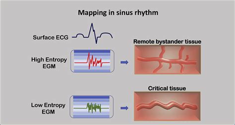 Signature Signal Strategy Electrogram Based Ventricular Tachycardia Mapping Heart Rhythm
