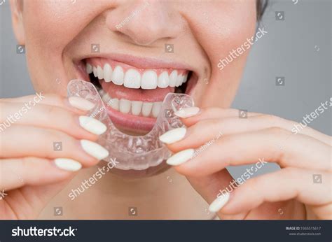 Retainer Over 42 978 Royalty Free Licensable Stock Photos Shutterstock