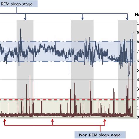 Results Of The Sleep Stage Classification Download Scientific Diagram