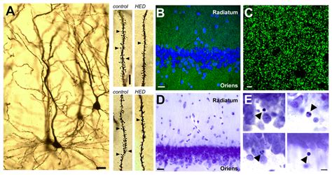 Diet Induced Insulin Resistance Impairs Hippocampal Synaptic Plasticity
