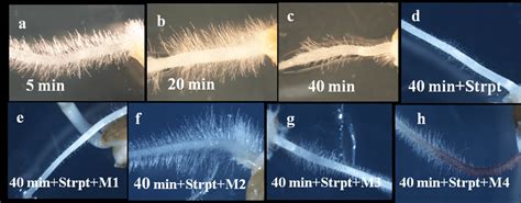 Drop Collapse Assay And Screening Of Lipopeptide Genes In M4 Isolate