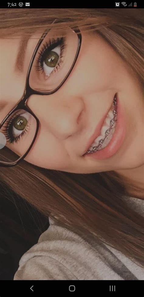 Braces R Bracesxxx