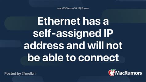 Ethernet Has A Self Assigned Ip Address And Will Not Be Able To Connect