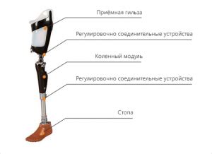 ПРОТЕЗЫ НИЖНИХ КОНЕЧНОСТЕЙ