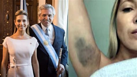 Expresidente Alberto Fernández Es Denunciado Por Violencia Doméstica