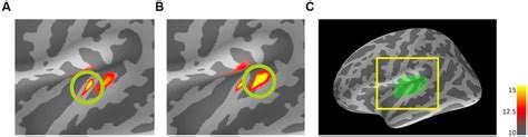 dynamic statistical parametric maps dspm results of mean activations