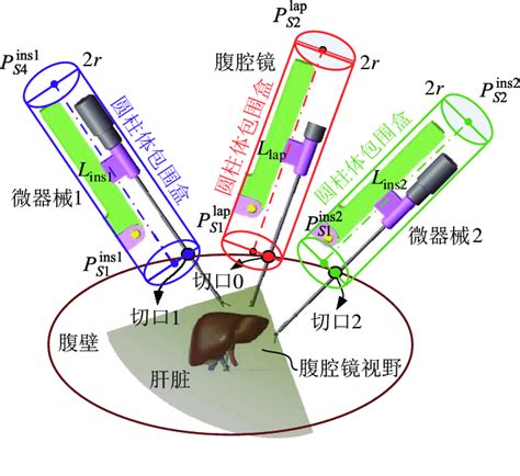 The Schematic Diagram Of Collision Detection Between The Robotic Arms Download Scientific Diagram