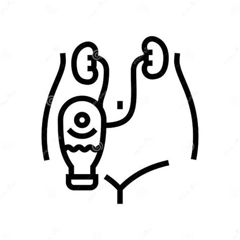 泌尿外科线图标矢量图插图 向量例证 插画 包括有 膀胱炎 符号 肾脏 石头 癌症 短文 例证 312298320