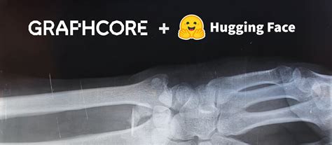 Deep Dive Vision Transformers On Hugging Face Optimum Graphcore