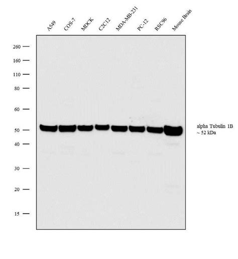 Tubulin Alpha 1B Antibody PA5 21979