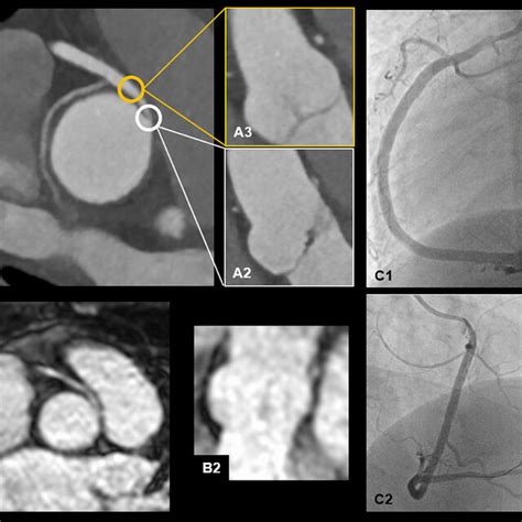 Comparing Imaging Modalities For Anatomy Ccta Cmr And Invasive