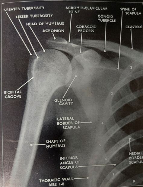 Anatomically Labelled X Ray Images 1920 Artofit