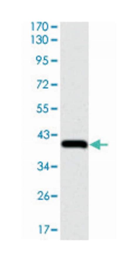 Anti Nedd8 Antibody 100ul