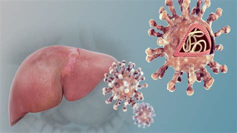 España Encabeza La Lucha Contra La Hepatitis C Podría Eliminar La