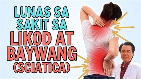 Lunas Sa Sakit Sa Likod At Baywang Sciatica By Doc Willie Ong Youtube