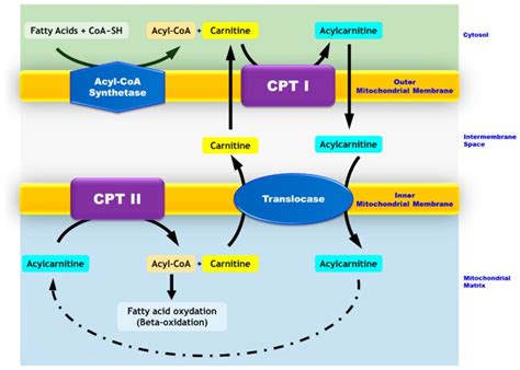 Acute Respiratory Infection Unveiling Cpt Ii Deficiency Abstract