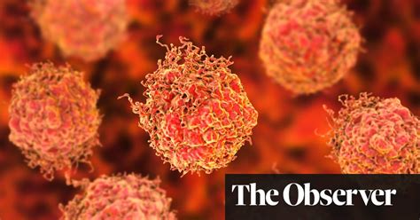 The Prostate Project On Linkedin New Screening Trial Could Save