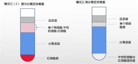小鼠外周血中性粒细胞分离液试剂盒 天津灏洋 TBD 山进生物