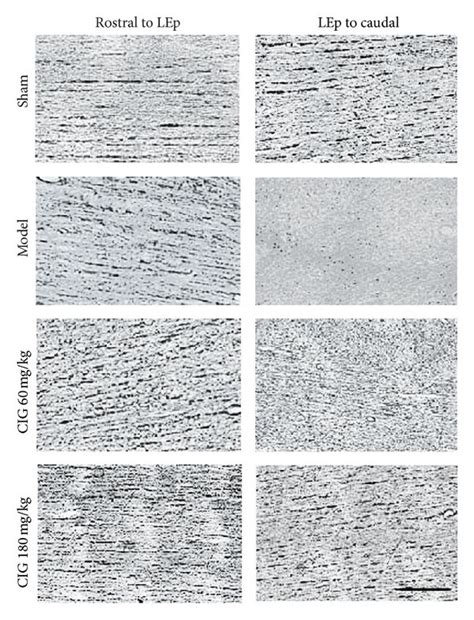 Effects Of Cig On Bda Labeled Axons Passing Through Lesion Epicenter In