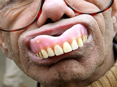 Man Arrested For Giving Customers Bad Chompers Nbc 6 South Florida