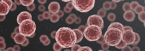 Could Ai Algorithms Improve Breast Cancer Prediction Idt