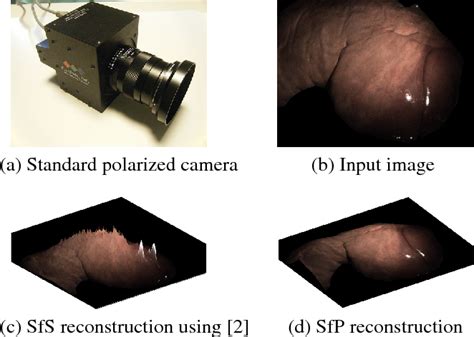 Figure 1 From Shape From Polarization In Laparoscopy Semantic Scholar