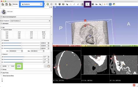 screen capture of the 3d slicer interface in conventional view for