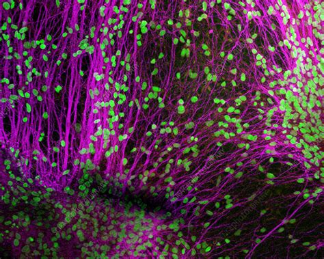 Stem Cell Derived Neurons Light Micrograph Stock Image C056 9617 Science Photo Library