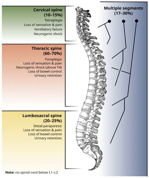 Proportion Of Metastases For Each Spine Segment Cervical Thoracic