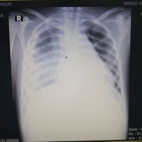 The First Day Of Picu Admission Download Scientific Diagram