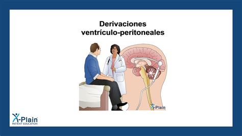 Derivaciones Ventrículo Peritoneales Youtube