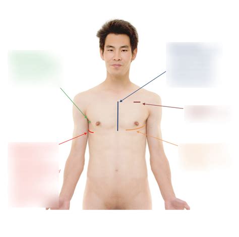 Axillary Thoracotomy