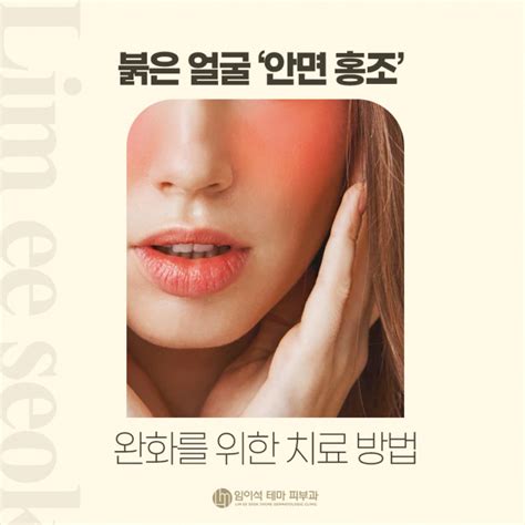 붉은 얼굴 안면 홍조 완화를 위한 치료 방법 네이버 블로그