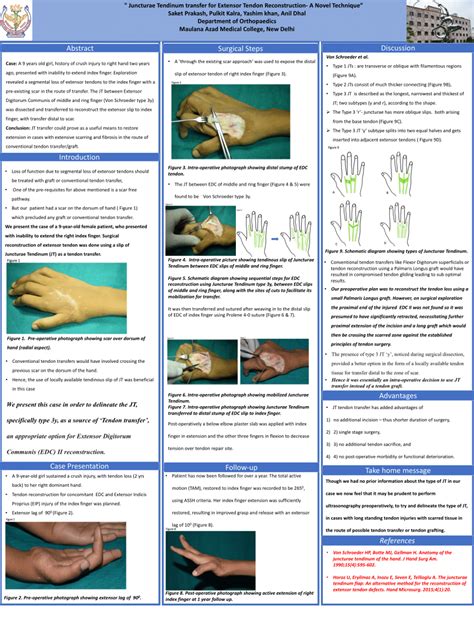PDF Juncturae Tendinum Transfer For Extensor Tendon Reconstruction A