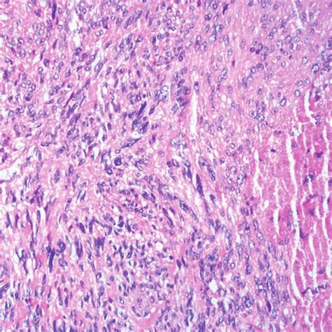 Hematoxylin And Eosin Staining Of Paraffin Embedded Section Showed