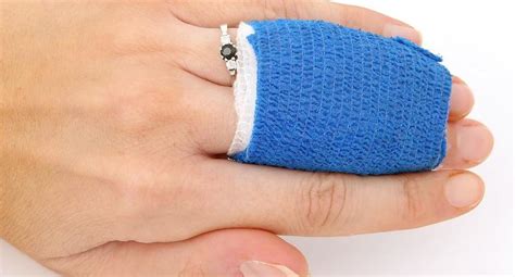 Crean Pegamento De Sellado Rápido Para Heridas Inspirado En Los