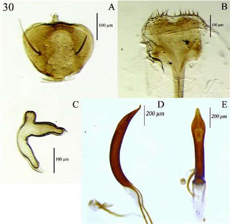Diagnostic Features And Terminalia Of M Caseyi [jf2015] A Labial Download Scientific Diagram