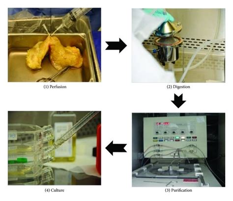 Human Islet Isolation Procedure 1 Pancreas Perfused With Enzymatic Download Scientific
