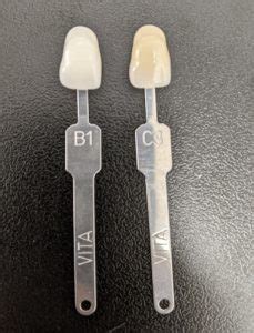 B Tooth Color Photo Comparison Guide Afterva Oral Health Library