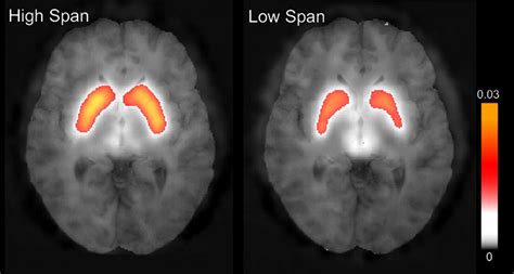 Working Memory Capacity Predicts Dopamine Synthesis Capacity In The Human Striatum Journal Of